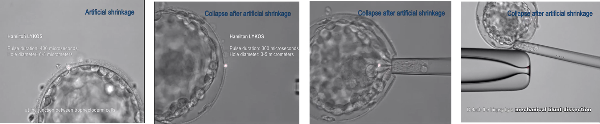 Lab Pills: Biopsy Techniques for Successful Results